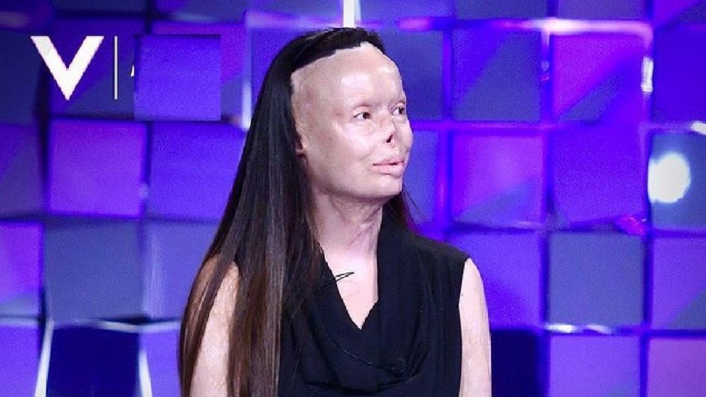 Valentina Pitzalis: chi è e l'attacco dell'ex marito, i dettagli della ...